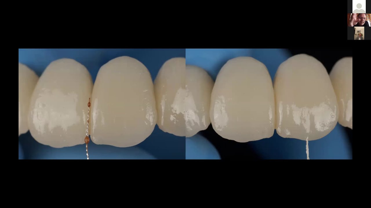 "Alejandro James y Murilo Calgaro" LIVE AID MASTERS OF DENTISTRY ...
