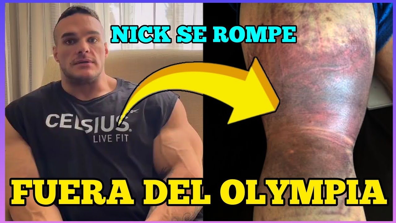 ⚠️ NICK WALKER FUERA DEL OLYMPIA 2023 ¡LESIONADO! Esto cambia TODO ...
