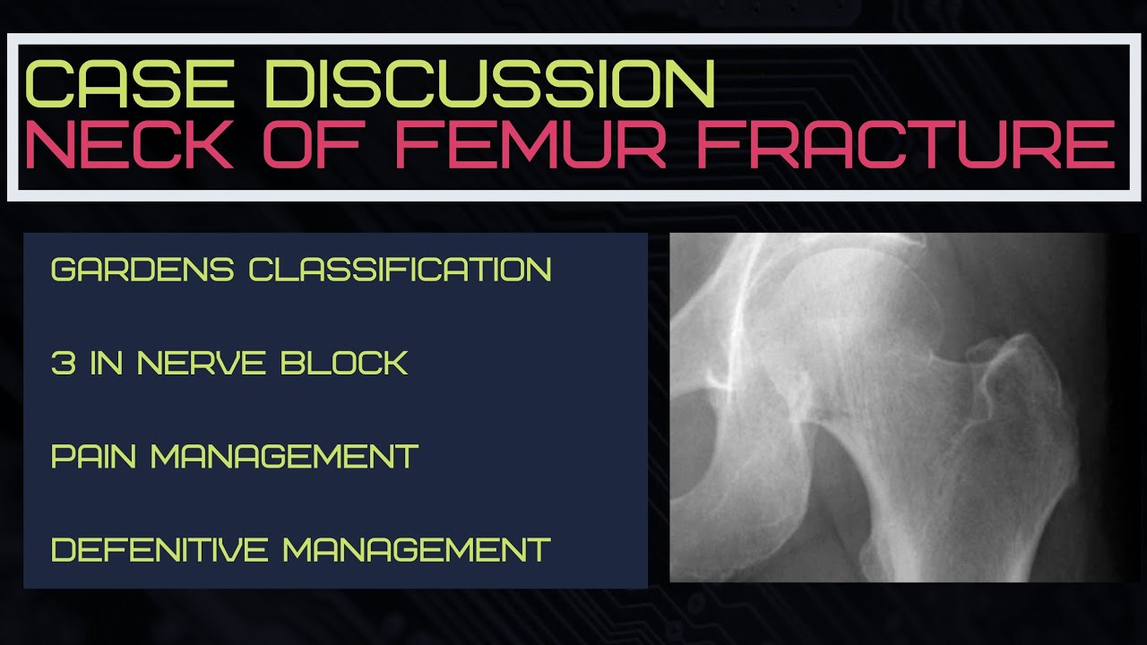 MBBS Case Discussion || Orthopedic Emergency || Neck of Femur fracture ...