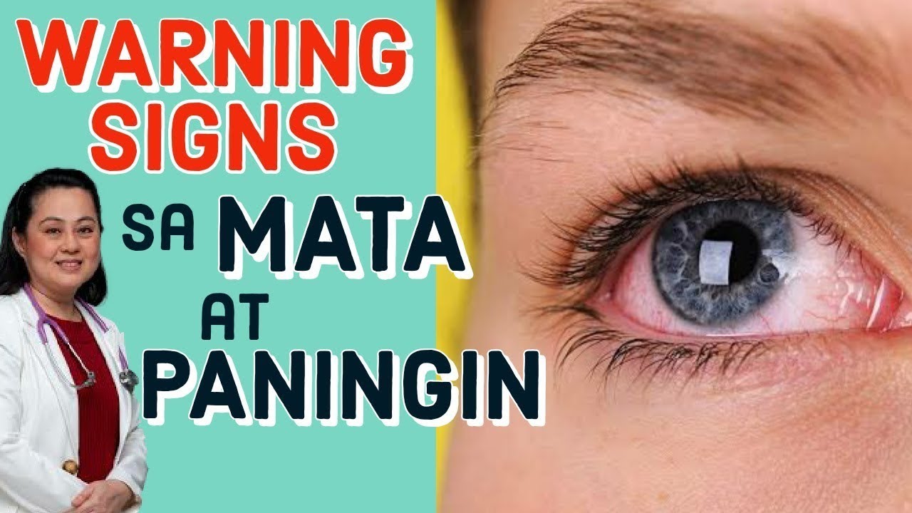 Warning Signs na May Problema sa Mata at Paningin - By Doc Liza Ramoso ...