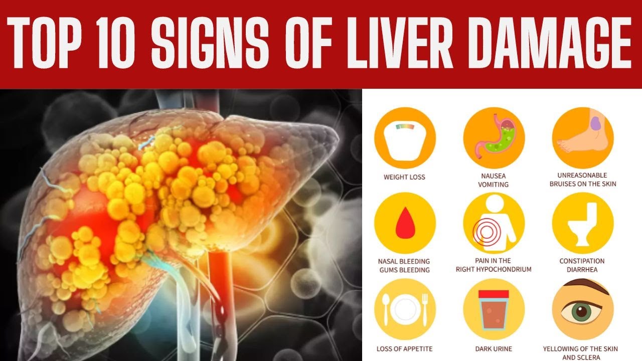 Top 10 Symbols of liver Damage #nutrition #food #life #viral # ...