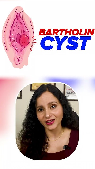 Ayurvedic Treatment Of Bartholin Cyst Best Treatment For Bartholin Cyst Youtube