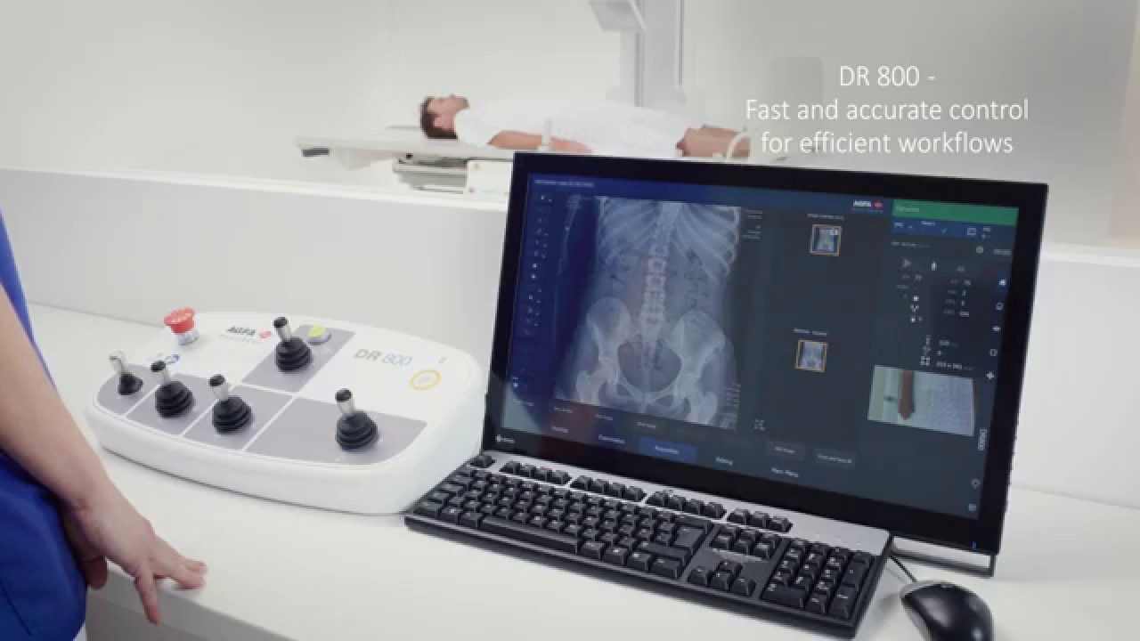 DR 800 | Remote joystick console (in English) | DR Room | Agfa ...