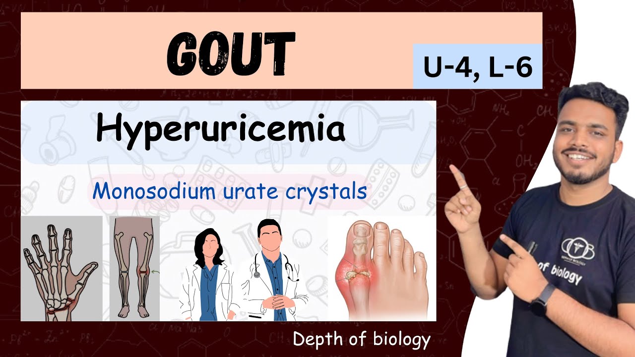hyperuricemia and gout || gout Pathophysiology || gout nursing || gout ...