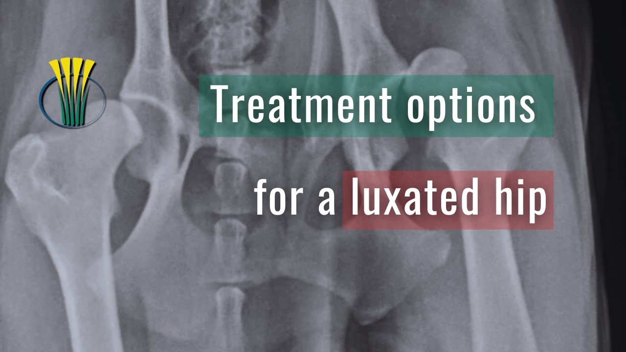 Treatment options for a luxated hip. - YouTube