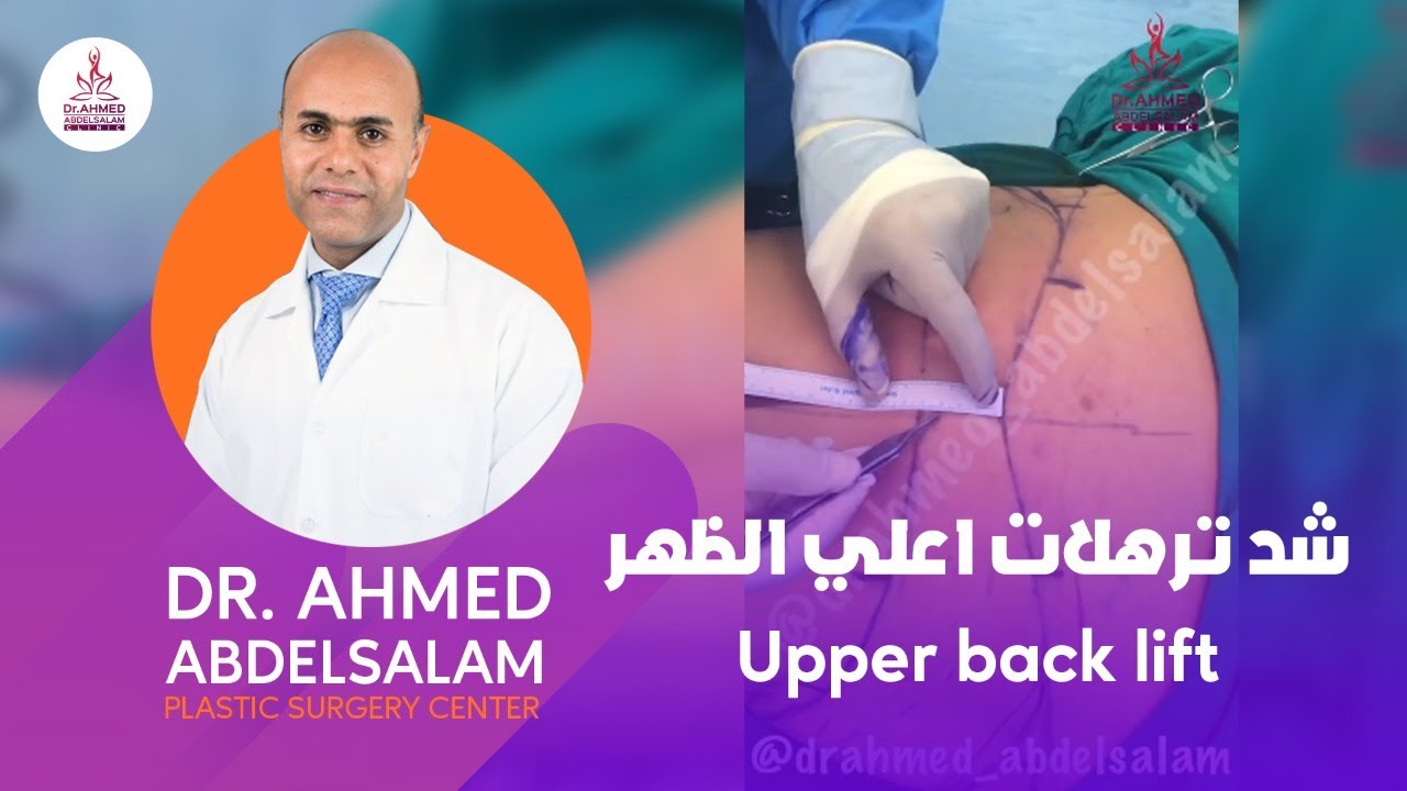 شد ترهلات اعلي الظهر... Upper back lift - YouTube