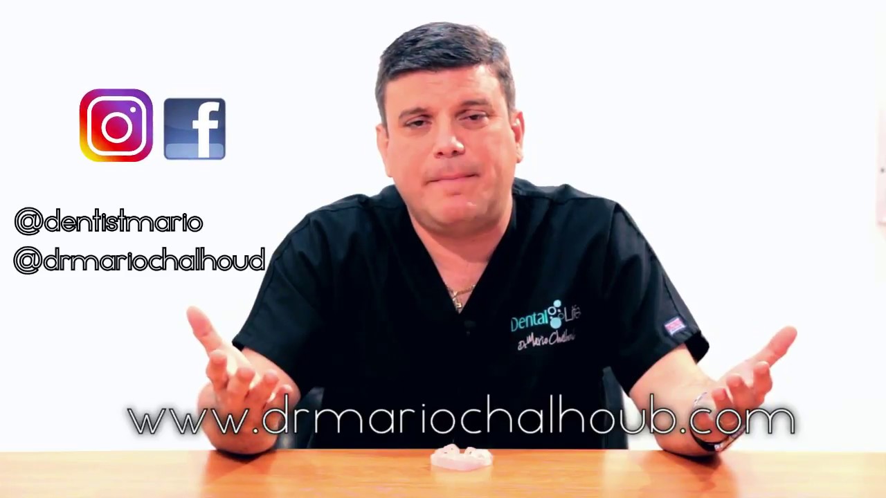 Implantes Dentales A que edad puedo colocarme los implantes Dr. Mario ...