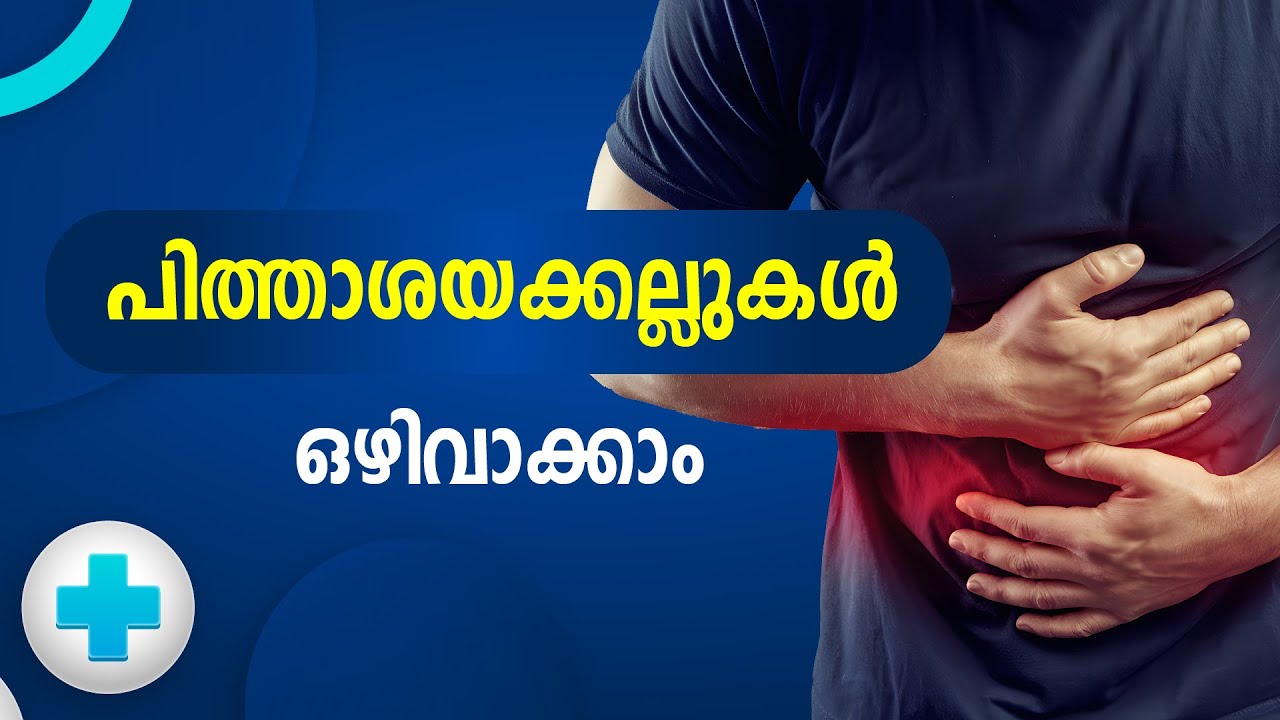 പിത്താശയക്കല്ലുകൾ ഒഴിവാക്കാം | Gallbladder Stone Treatment Malayalam ...