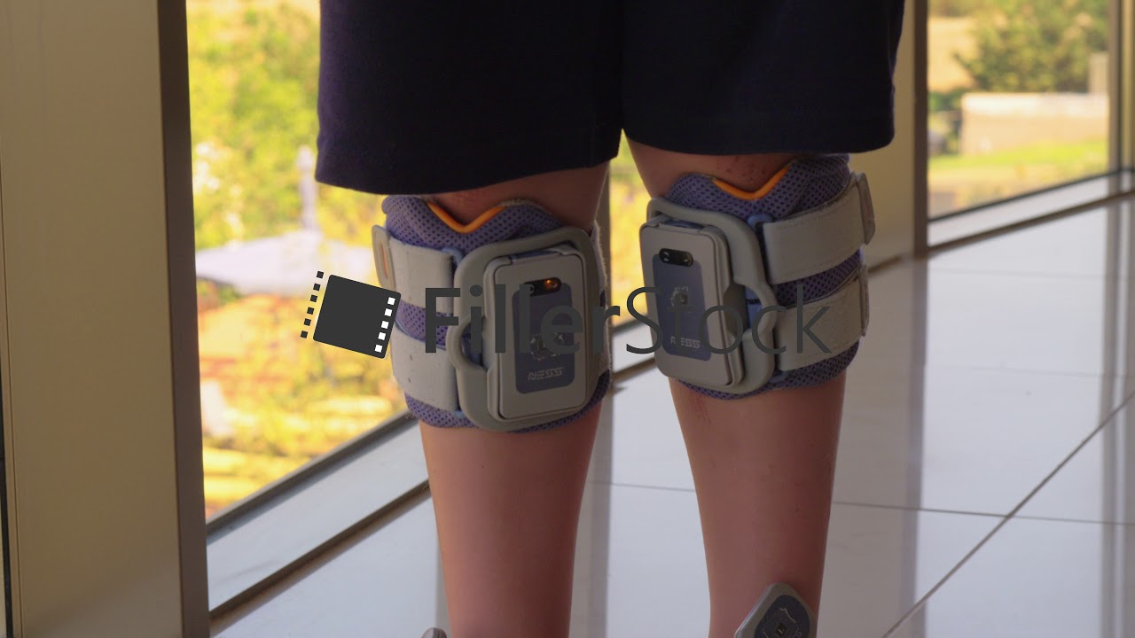 Child with foot drop system getting FES therapy - YouTube