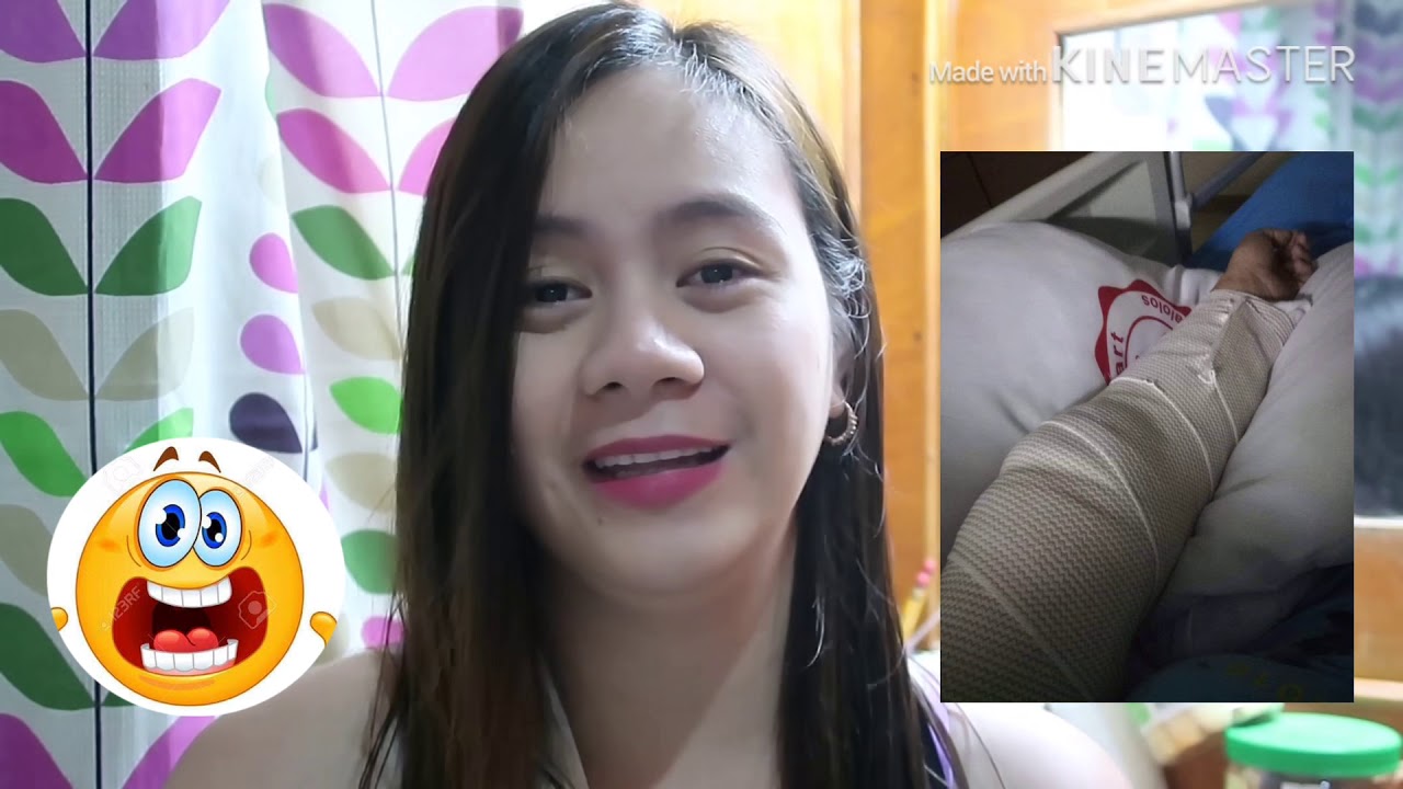 NABALIIAN AKO NG BRASO (LABAS ANG BUTO 😱NAKAKATAKOT😱) - YouTube