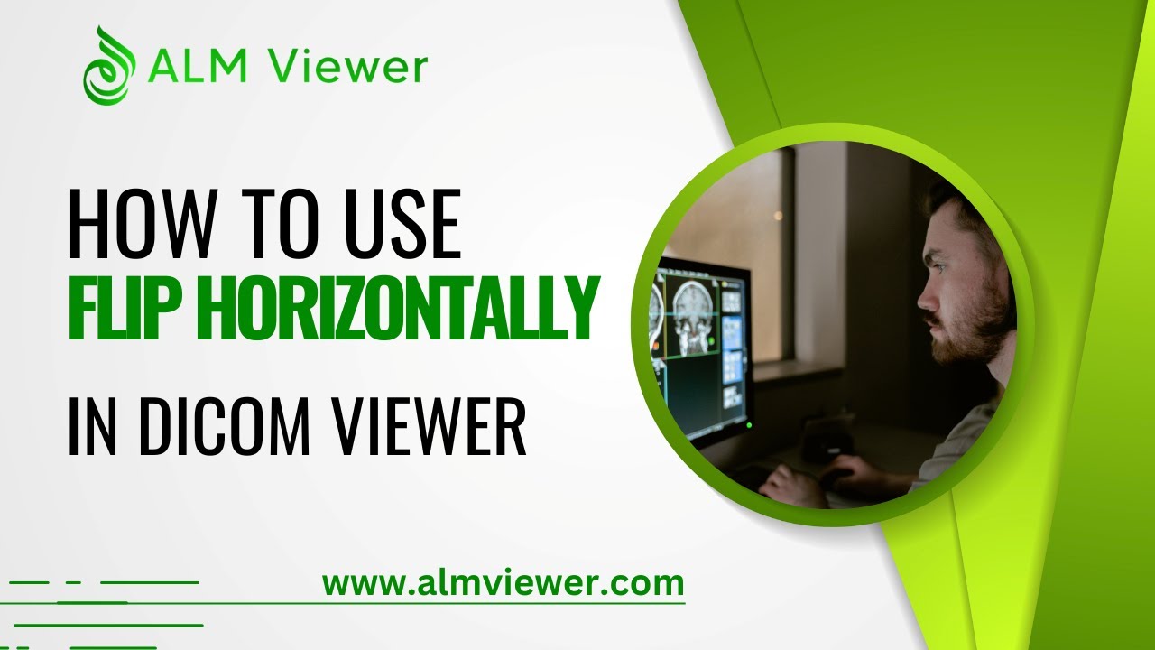 How to Use Flip Horizontally Tool in Dicom Viewer | By Alm Viewer - YouTube