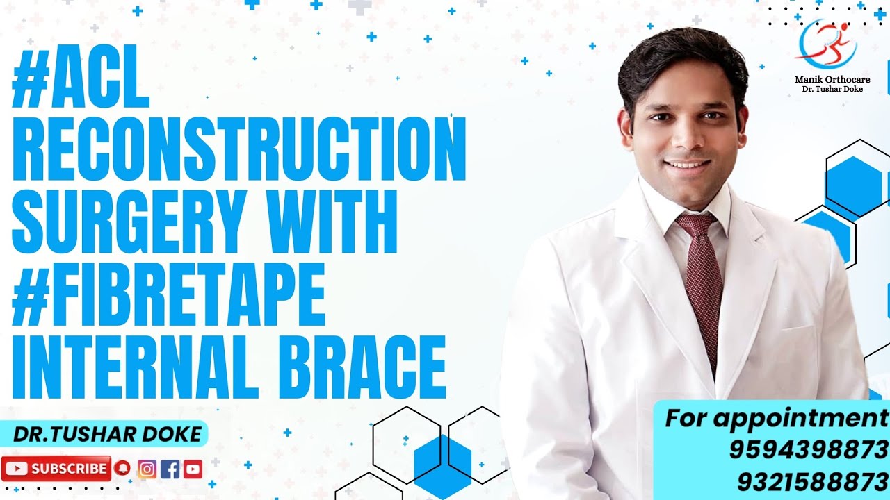#ACL Reconstruction surgery with #fibretape internal brace - YouTube