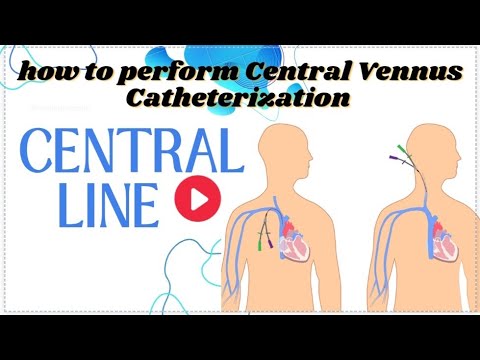 How to Central Venous Catheter insert in Internaljugular vein MEDICO AS ...