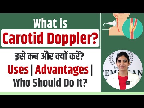 What is Carotid Doppler? | Uses, Advantages & Who Should Do It | Dr Almas Khan