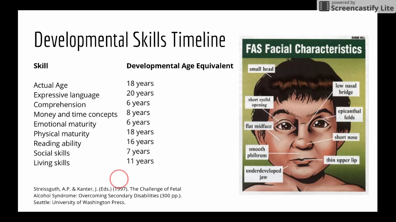 Understanding FASD for Educators - YouTube