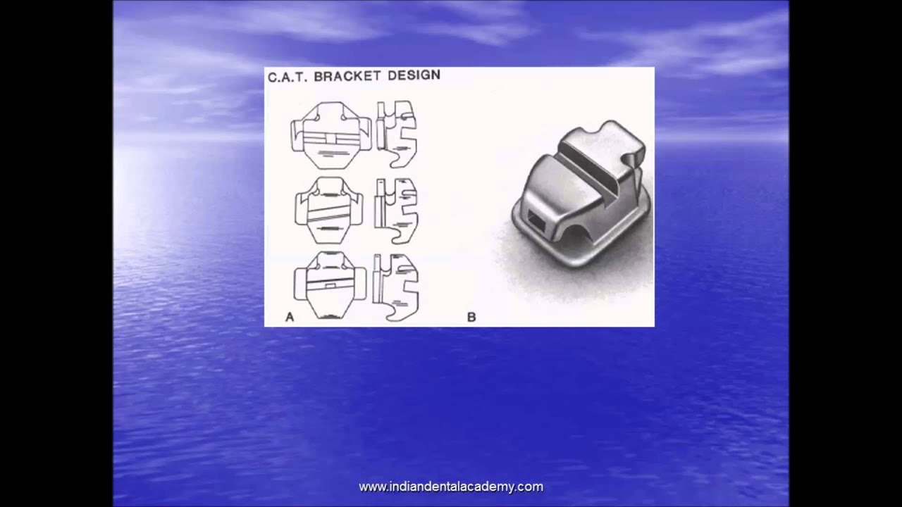 modified begg technique / orthodontic courses by Indian dental academy ...