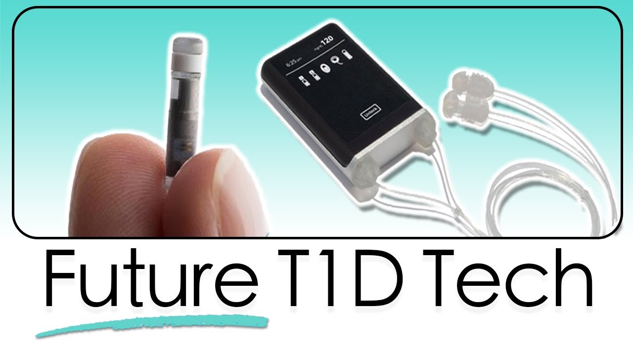 Future Diabetes Tech - Where it is Now & Where it's Headed - YouTube