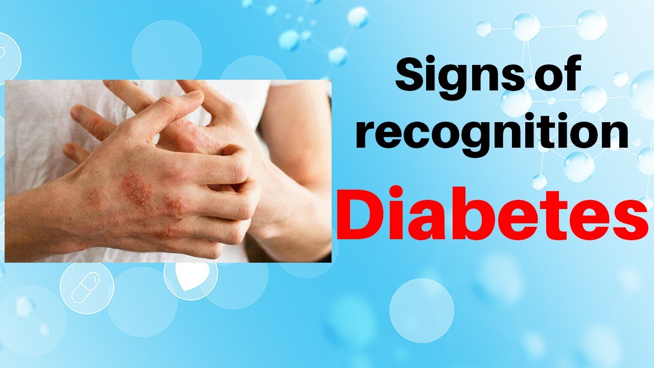 Warning - Signs on the body that indicate you may have diabetes - YouTube