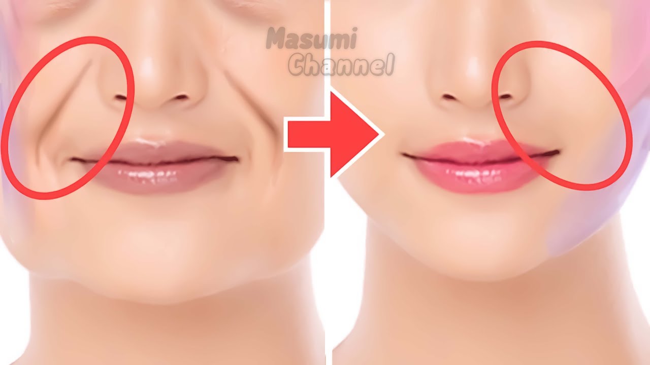 5mins SMILE LINES Facial Exercises (Nasolabial Folds/ Laugh Lines) | No ...
