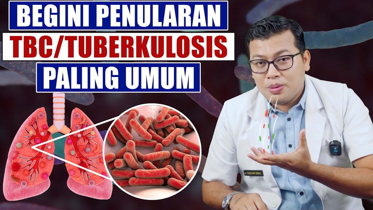 CARA PENULARAN TBC TUBERKULOSIS YANG PALING UMUM - DOKTER SADDAM ISMAIL - YouTube