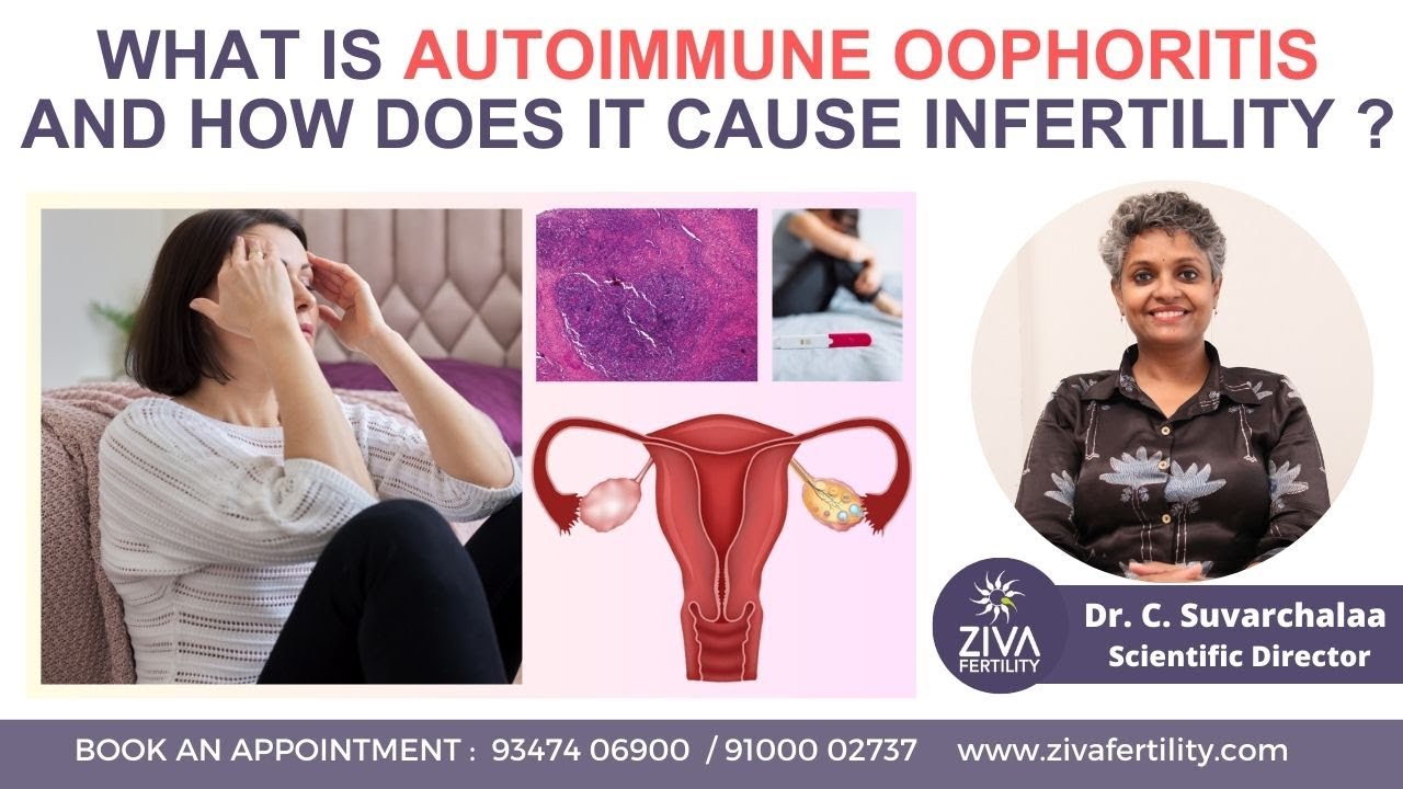 Autoimmune Oophoritis And Infertility | IVF | ICSI | Dr C Suvarchala ...