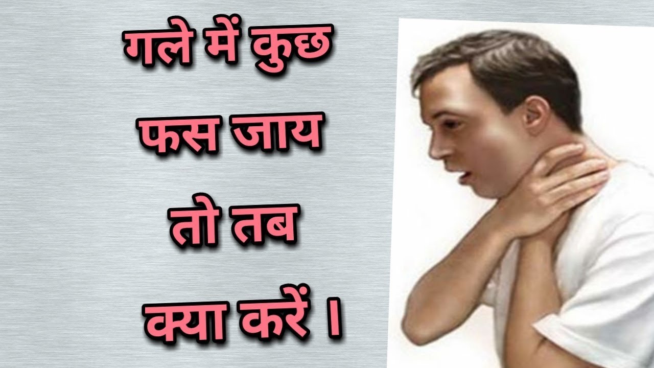 How to remove foreign body airway obstruction of adult - YouTube