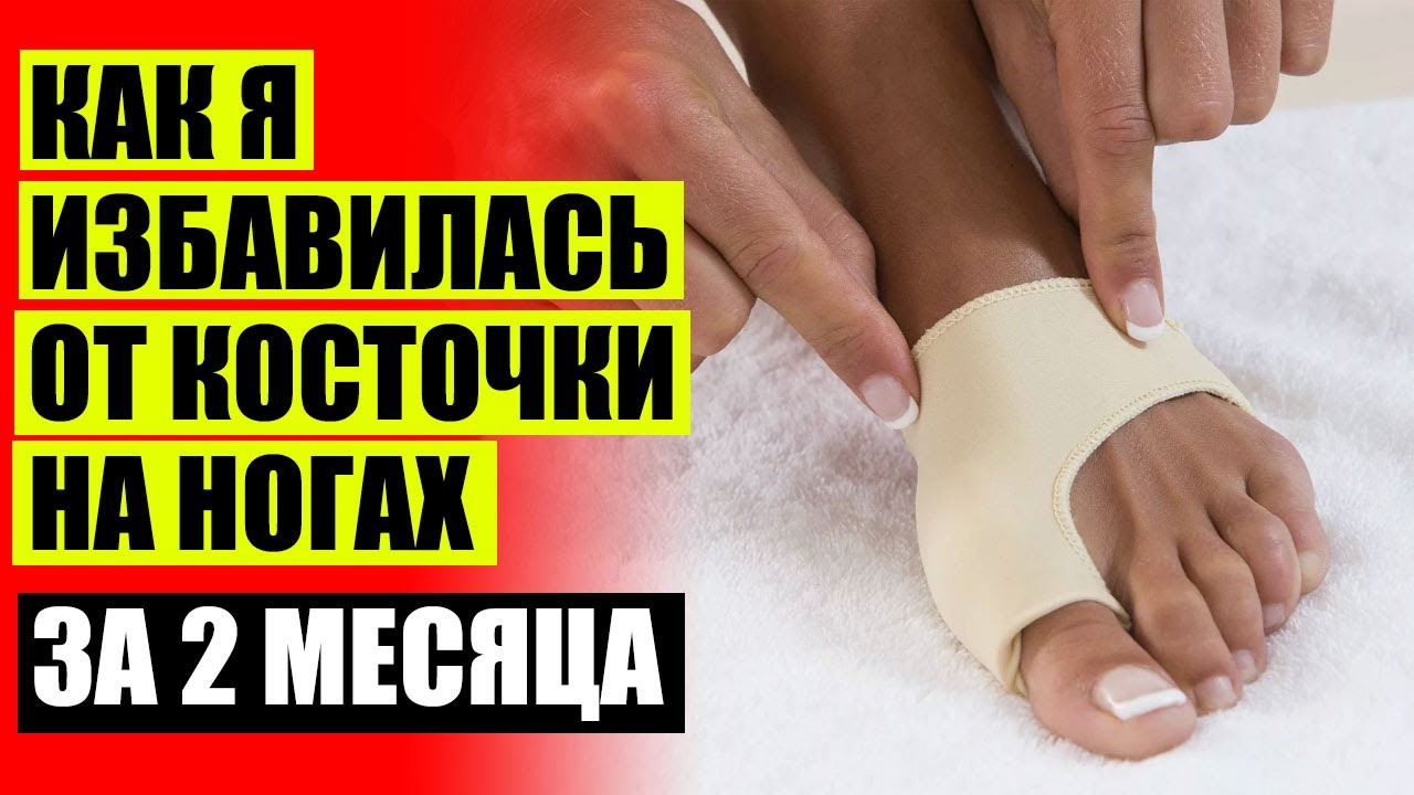 🤕 Операция на большой палец ноги ⭐ Шишка на большом пальце фото Youtube