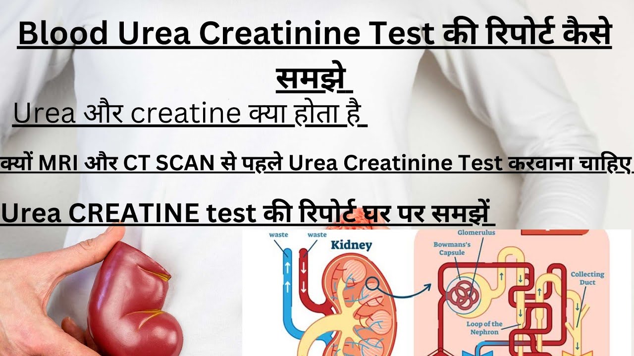 Serum Creatinine and Urea Test| Contrast MRI CT SCAN से पहले Urea ...
