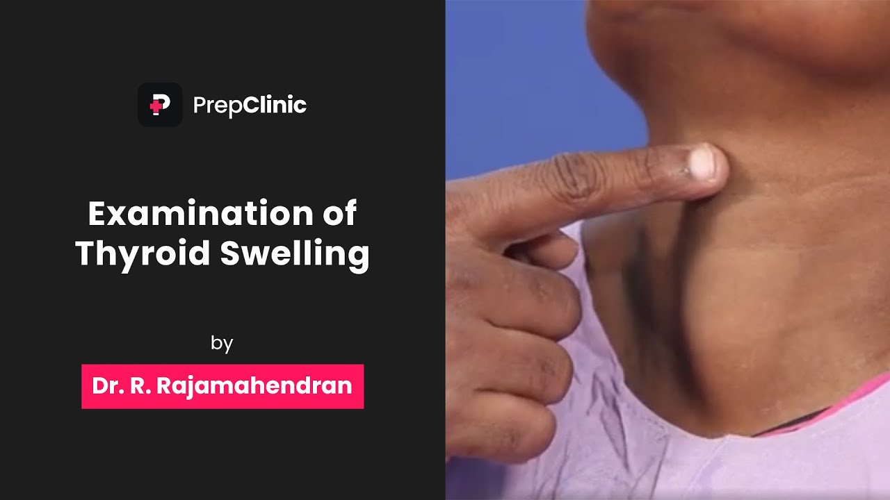 Examination of Thyroid Swelling | Dr. R. Rajamahendran | Surgery ...