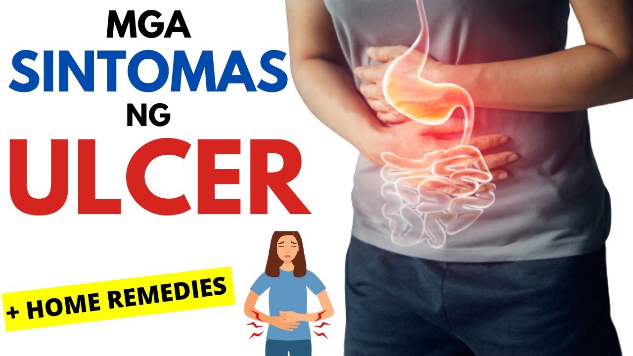 11 SINTOMAS ng ULCER | Bakit nagkaka-ULCER at ano ang HOME REMEDIES ...