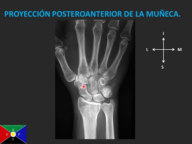 Anatomía De Los Huesos De La Mano, Radiografía Mano Esqueleto