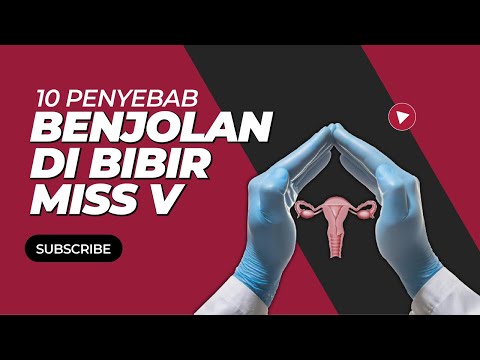 Benjolan di Bibir Miss V | Normal atau Bahaya ?