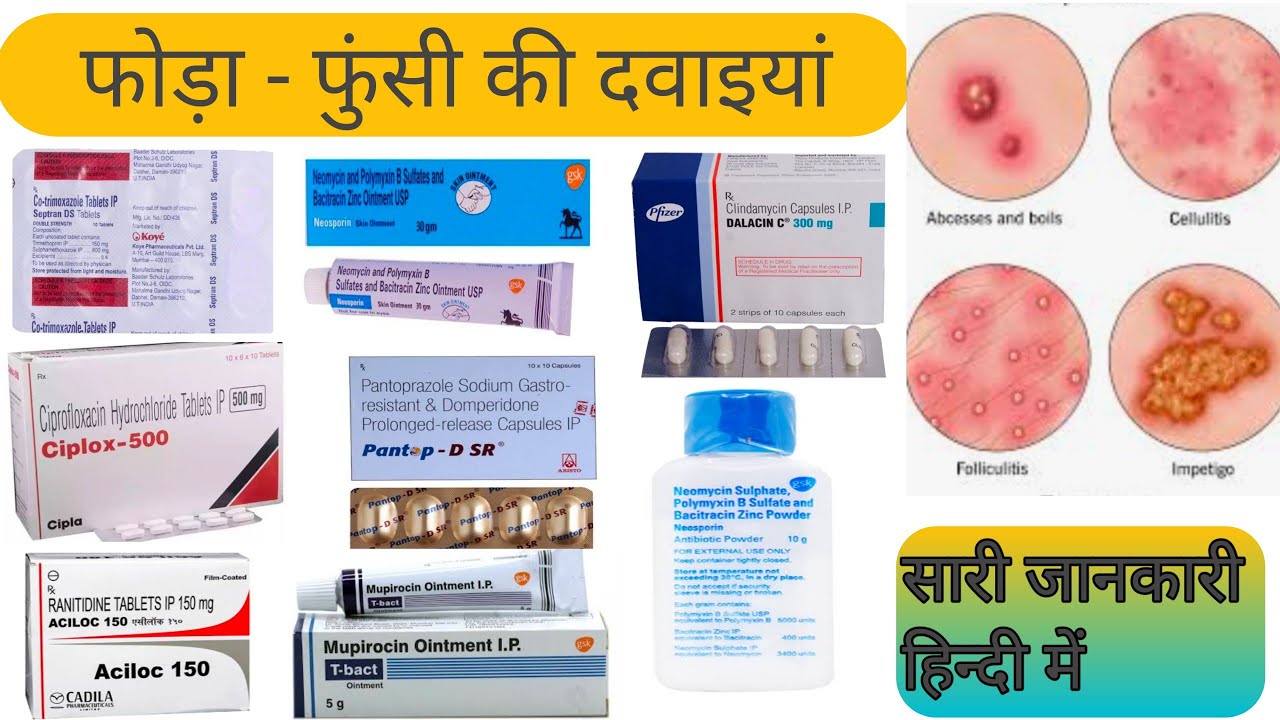 फोड़ा - फुंसी की दवाइयां । foda - funsi ki dawa। medicine। treatment ...