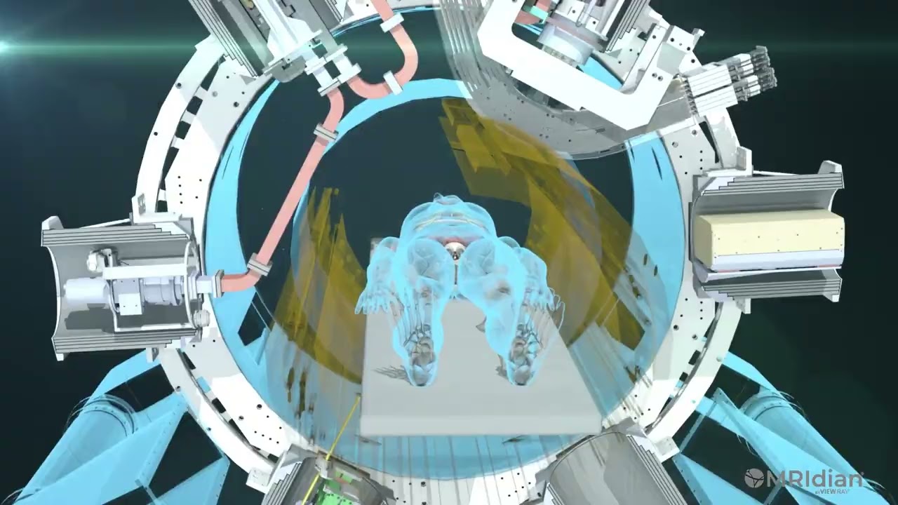 ViewRay MRIdian MR Linac explained (patients) - YouTube