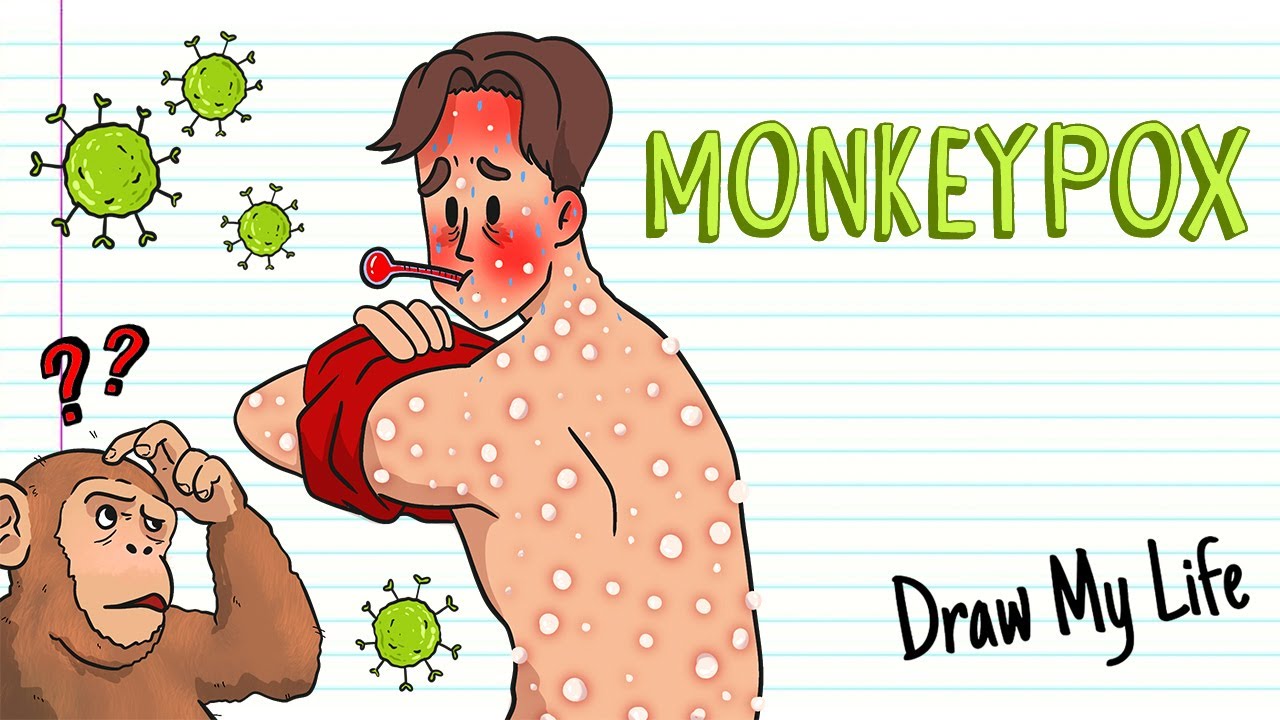 MONKEYPOX | Draw My Life - YouTube