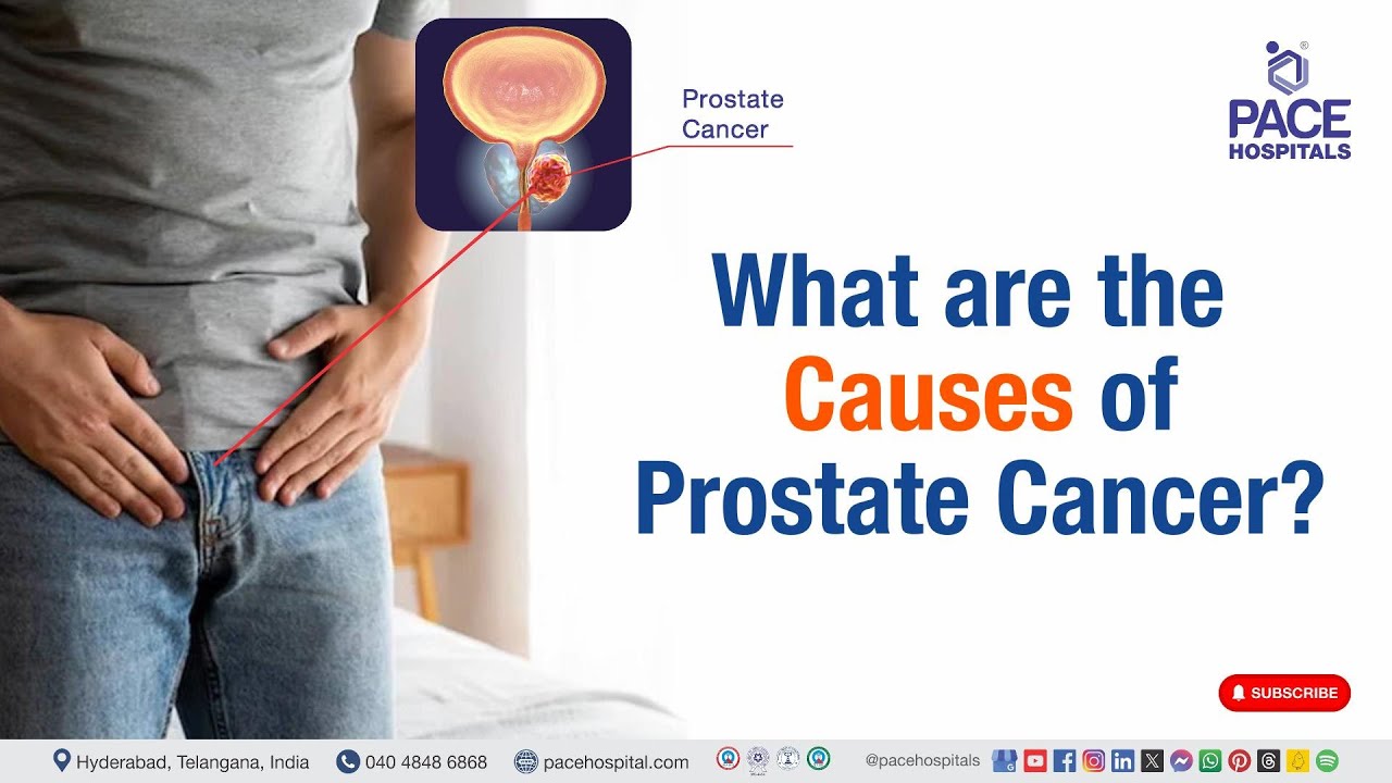 Causes of Prostate Cancer | What are the Causes of Prostate Cancer? | # ...