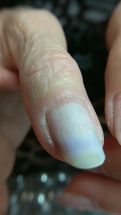 нігті після зняття гель лаку Nails December Youtube