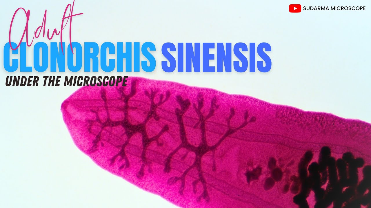Adult Clonorchis sinensis under the microscope - YouTube
