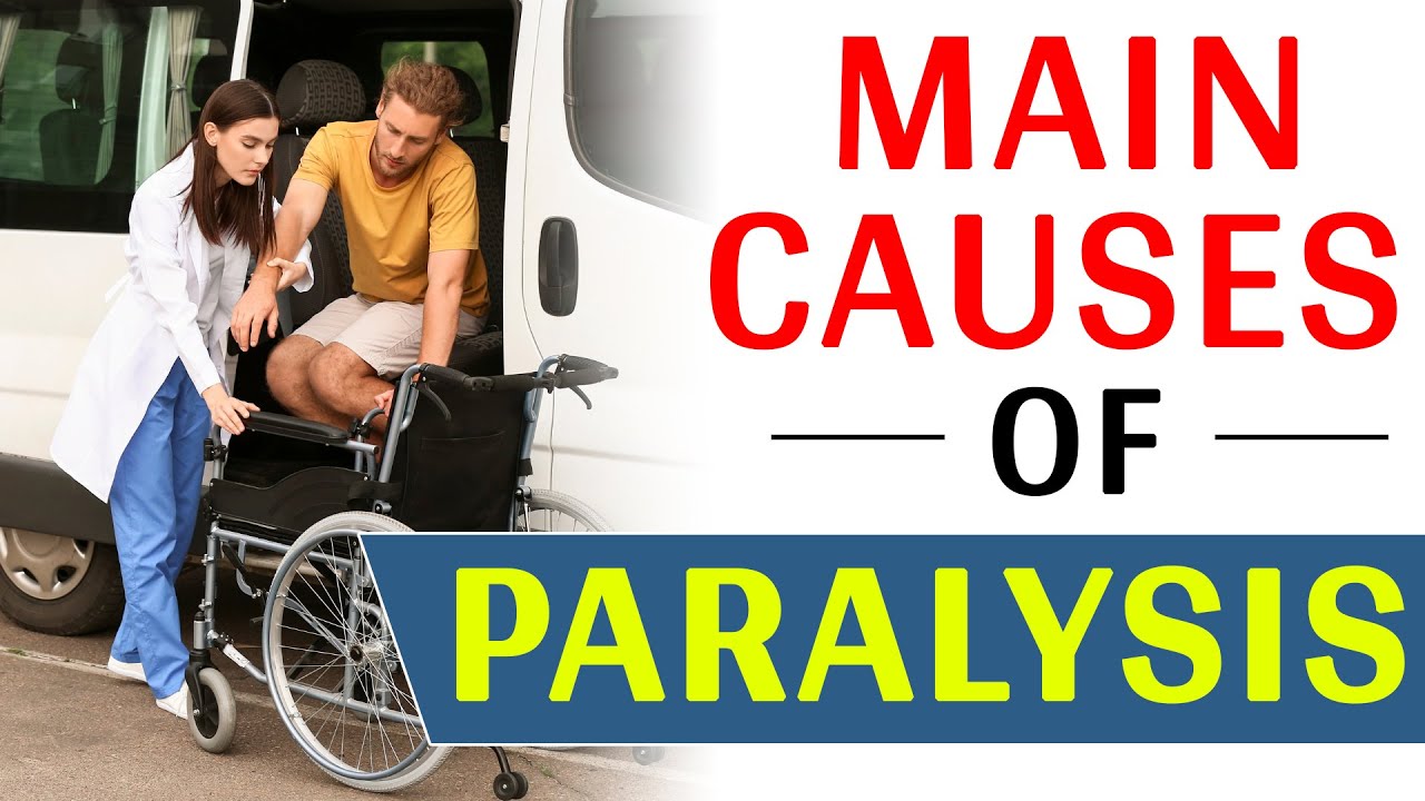 Lakwa kis karan hota hai | How to avoid Paralysis | लकवे से कैसे बचें - YouTube