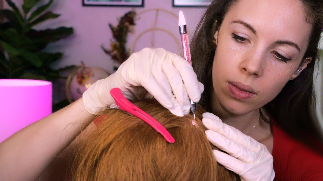 Asmr Scalp Check And Treatment With Bad Results Youtube