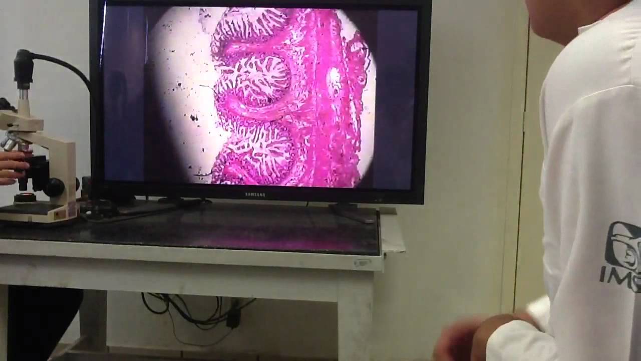 Histología del intestino grueso, delgado y esófago parte 1 - YouTube