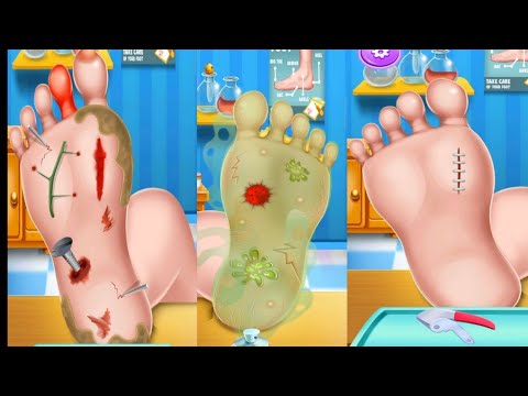 Foot Surgery Doctor Care Gameplay Walkthrough Level 1 | Polo Gaming ...