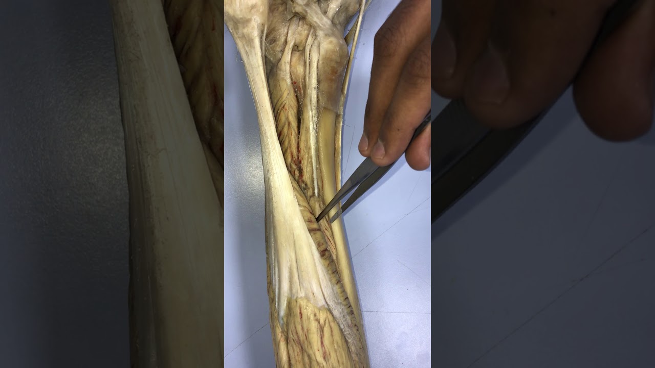 Anatomy of the LL pt.8 - Explanation on a plastinated model. - YouTube