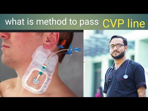 How CVP line is pass? what is CVP line? how we perform cvp line? #trending #viral#doctor - YouTube