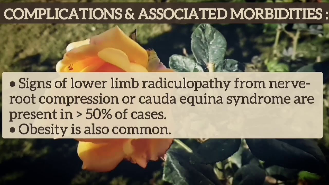 Achondroplasia Radiology Inheritance Symptoms Treatment Youtube