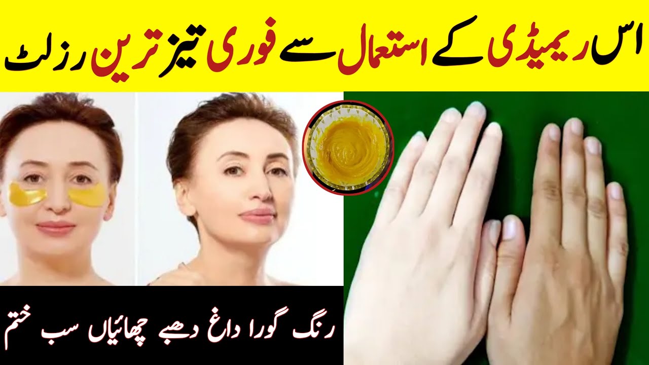 Instant Skin Whitening Remedy Naturally | 100% Works | 1 Day Skin ...