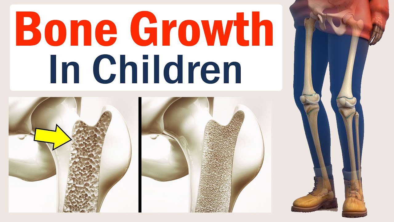 How Improve Bone Density in the children | Bone Growth | Everything You ...