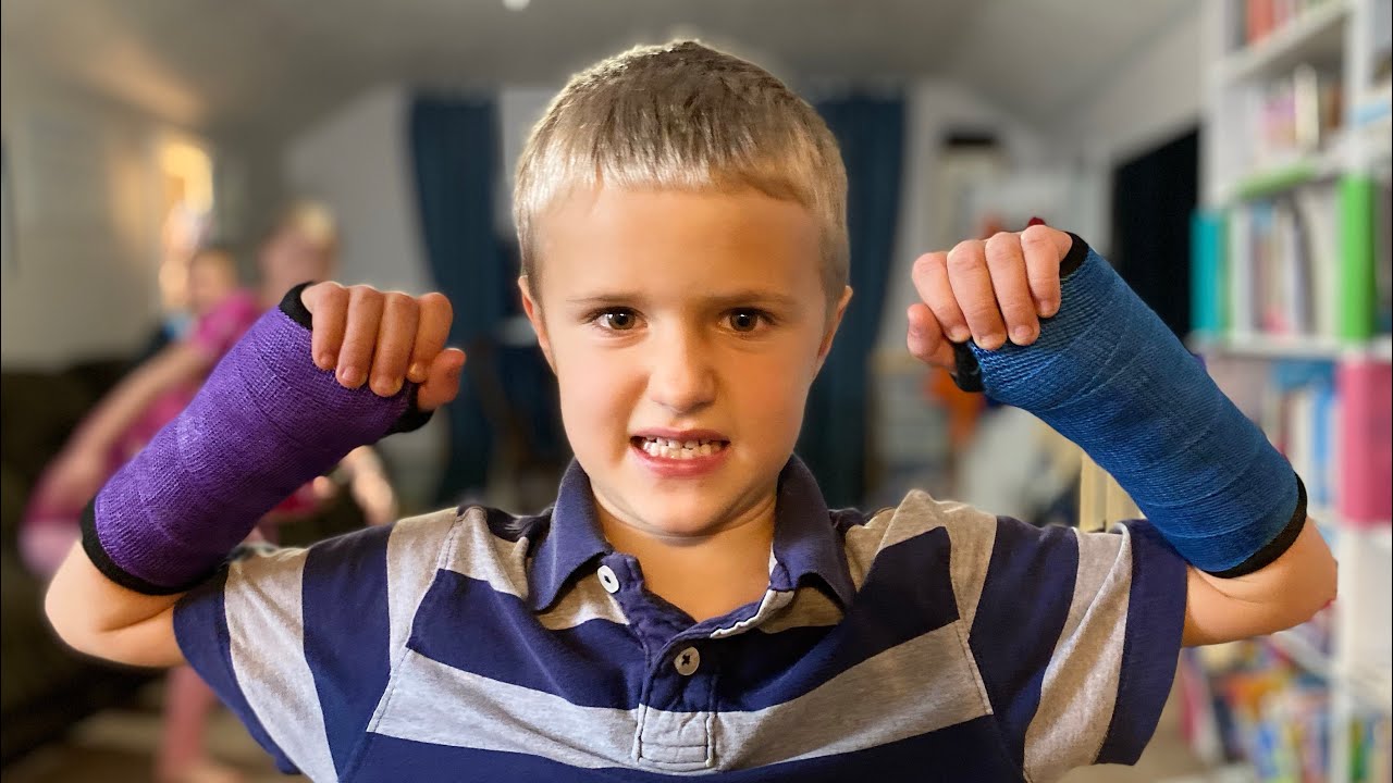 Broken | Both bones both arms. - YouTube