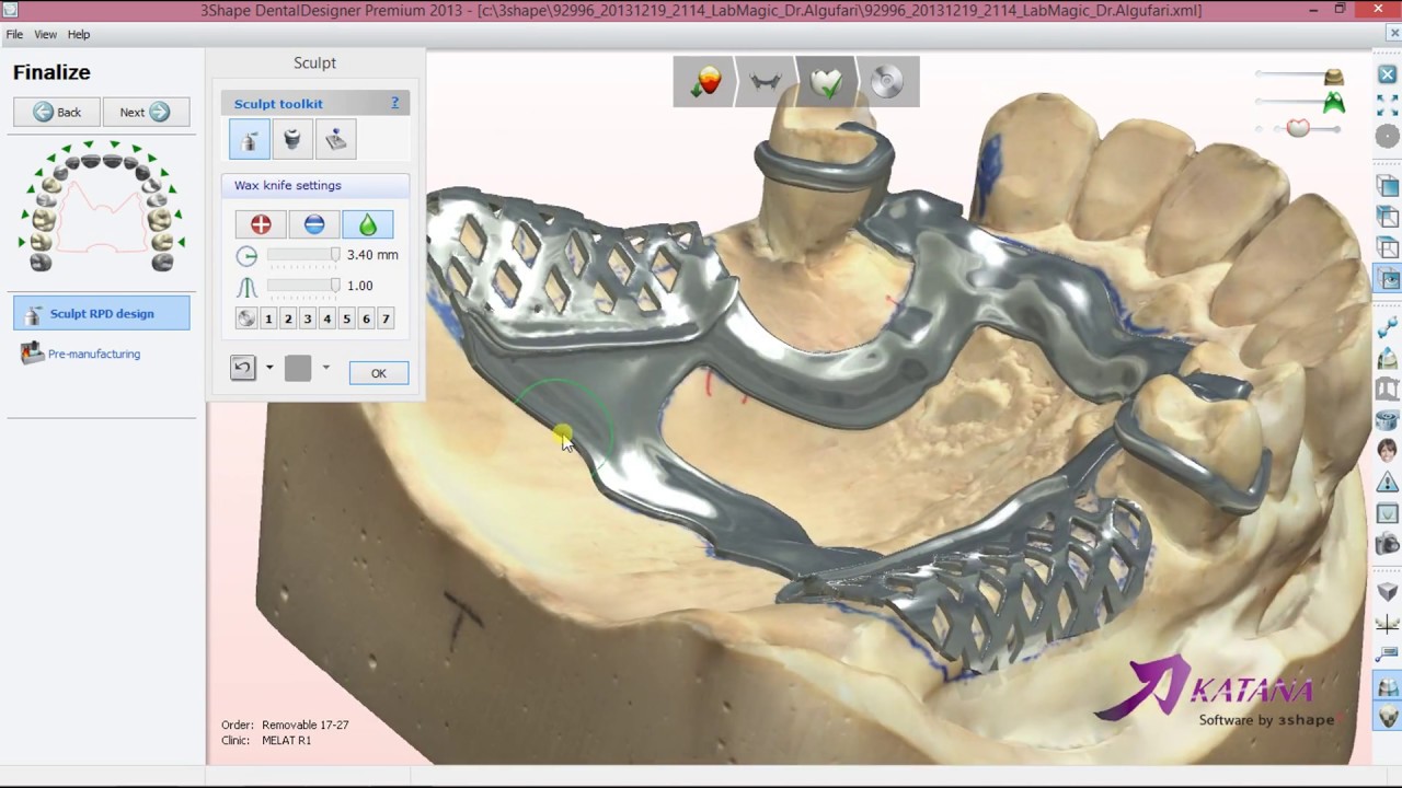 RPD Color Design - YouTube