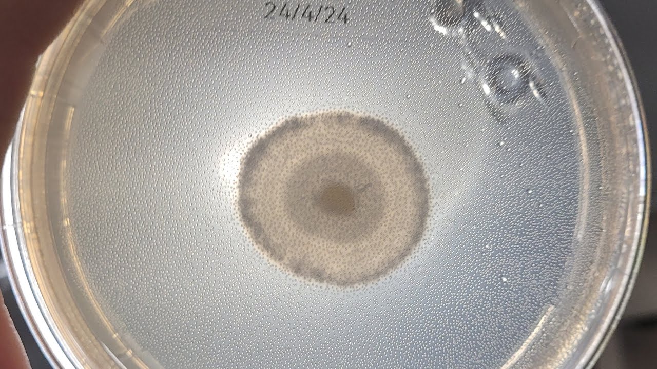 Open-air inoculation shenanigans. MS spore syringe to agar. - YouTube